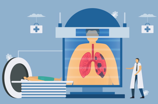 Preparing for a lung CT scan: why and how it is done and what should be ...